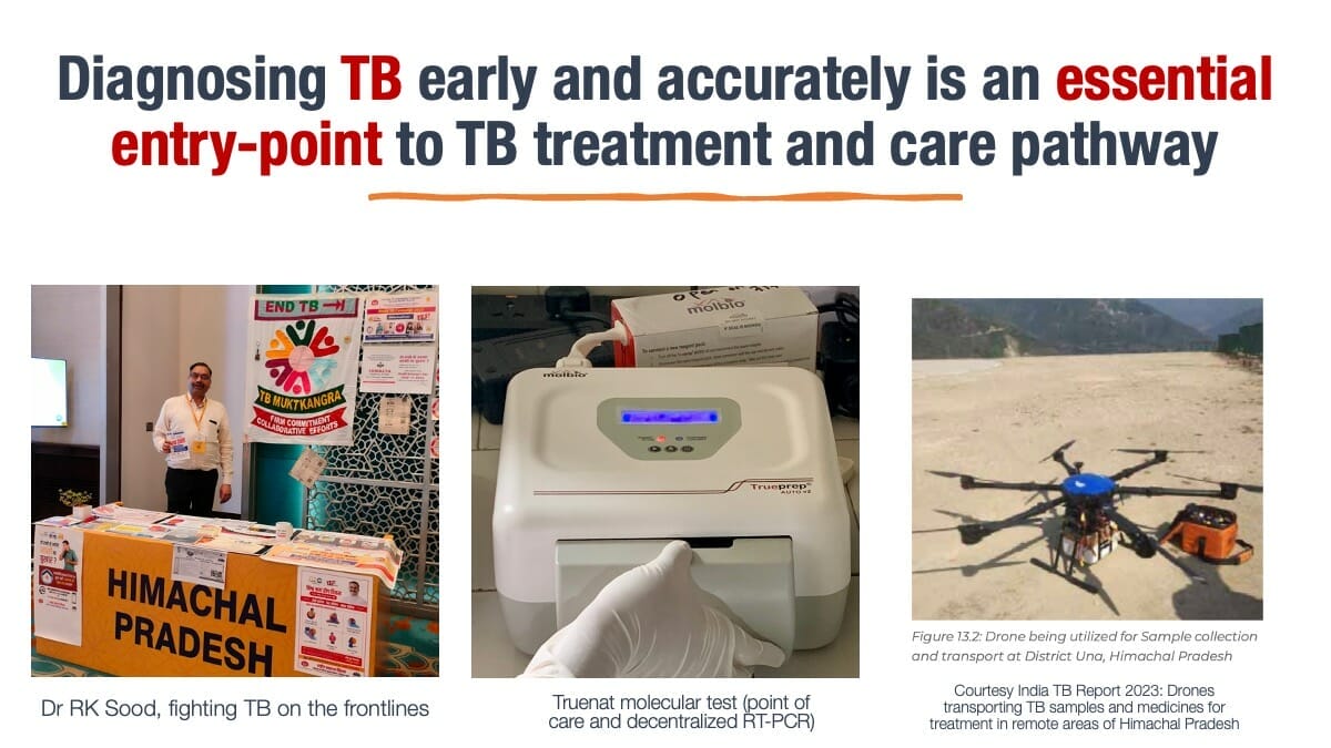 Early and accurate TB diagnosis is the gateway to #endTB pathway » Africa Global Village